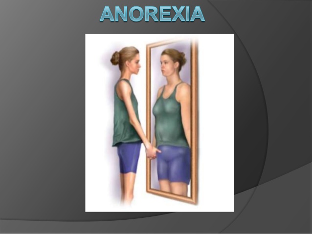 Anorexia Nervosa: How to Spot the Signs – CounselingRx