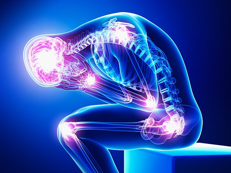 Pain: Chronic Pain is a Fundamental Health Issue – CounselingRx